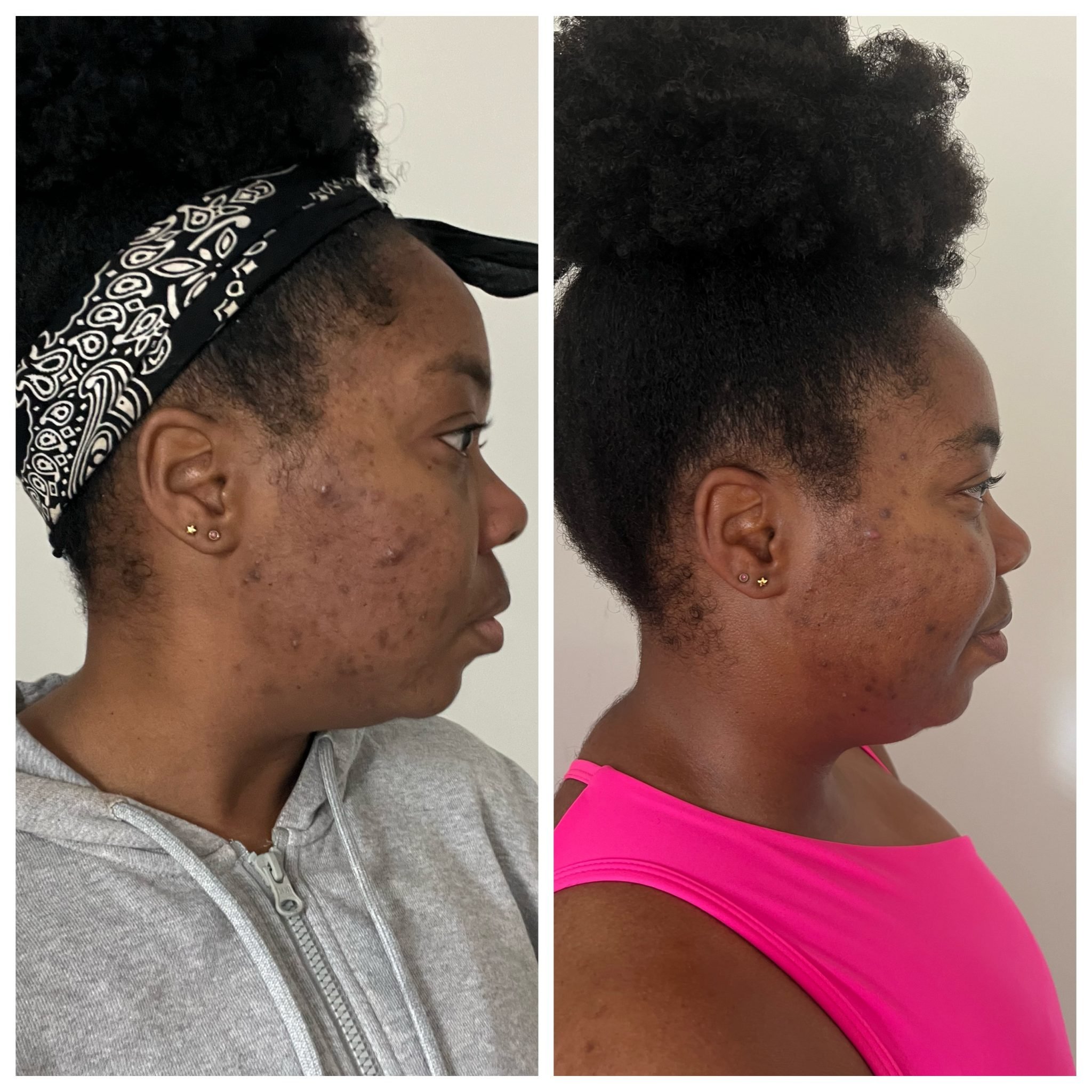 Bon Charge Face Mask Review | Red Light Therapy - keep it simpElle